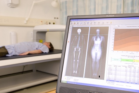 DEXA | NIHR Oxford Biomedical Research Centre