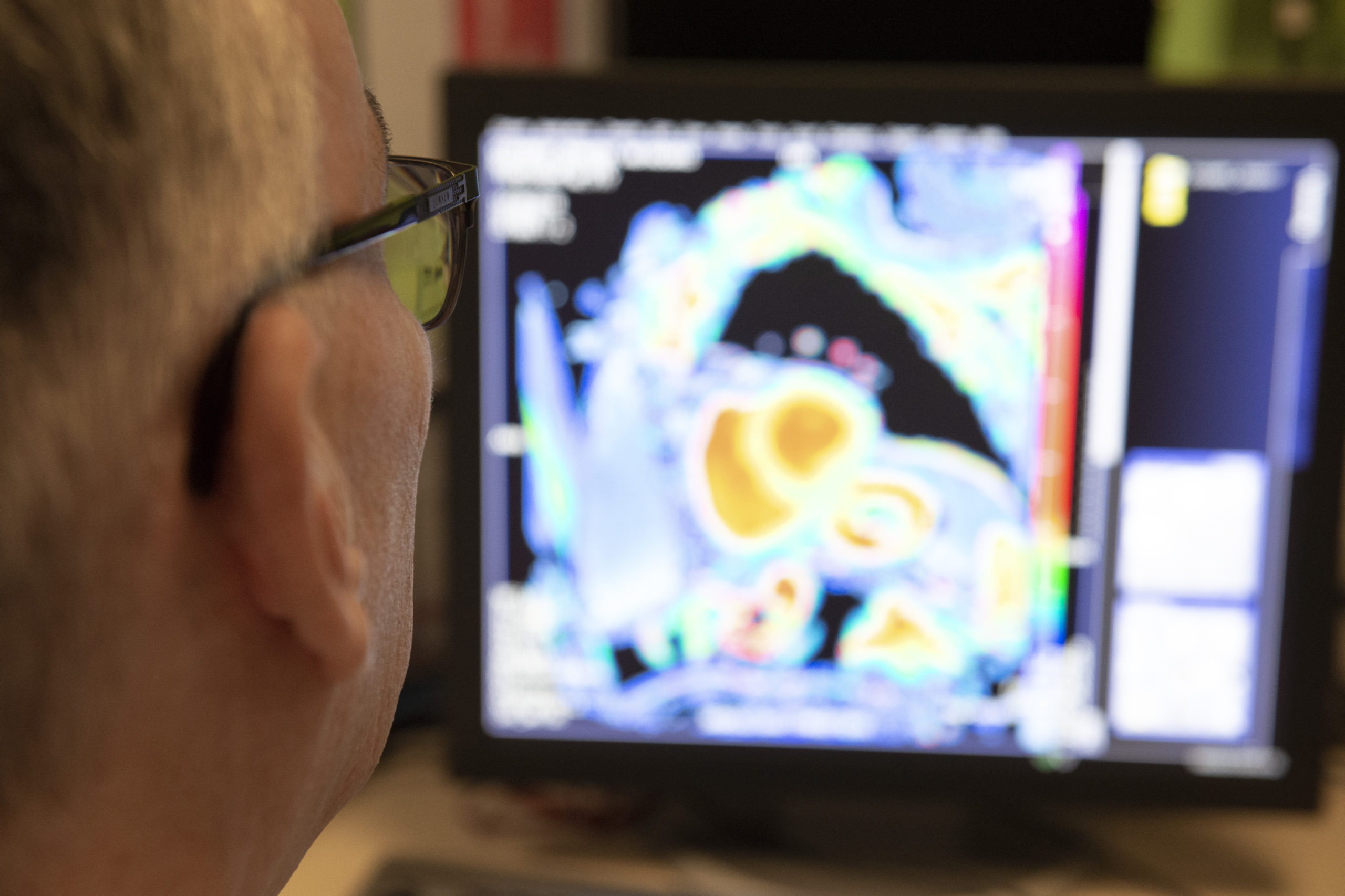 Oxford study reveals medium-term impact of COVID-19 | NIHR Oxford ...